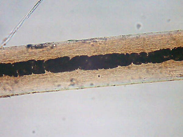 Horse Hair Under Microscope