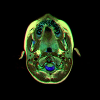Nevit's blog: Color MRI of the Brain