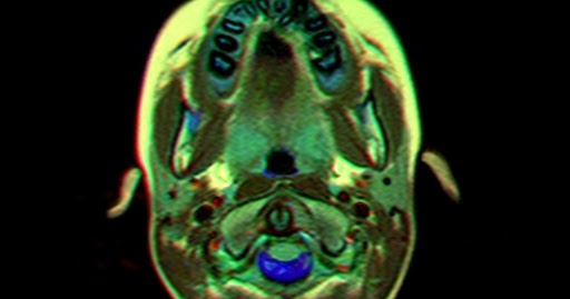 Nevit's blog: Color MRI of the Brain