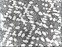 malayasteel: GRAPHITE STRUCTURES IN CAST IRONS : GRAPHITE DISTRIBUTION ...