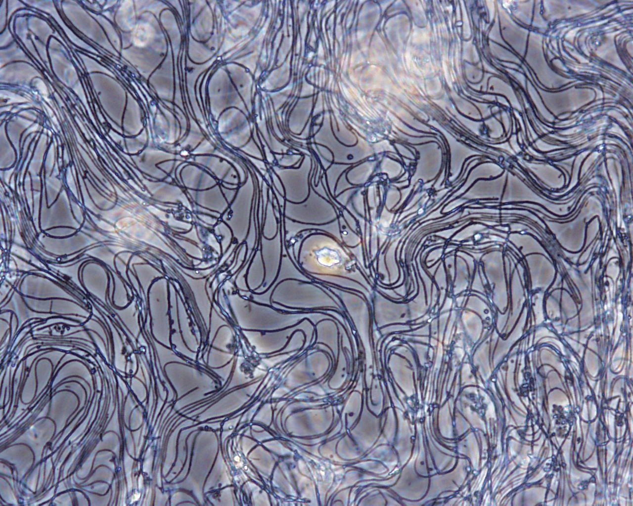 filamentous bacterium - meddic