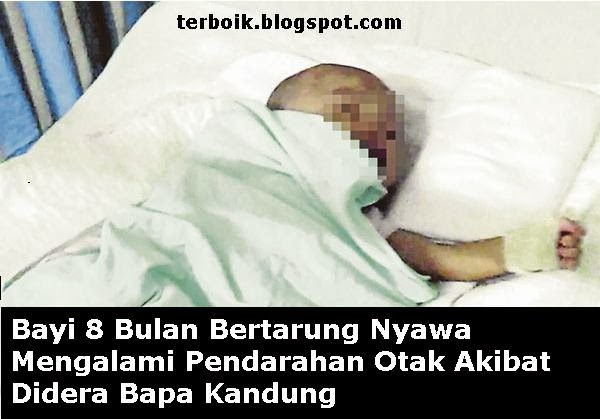 Bayi 8 Bulan Bertarung Nyawa Mengalami Pendarahan Otak Akibat Didera Bapa Kandung - Harian Metro ...