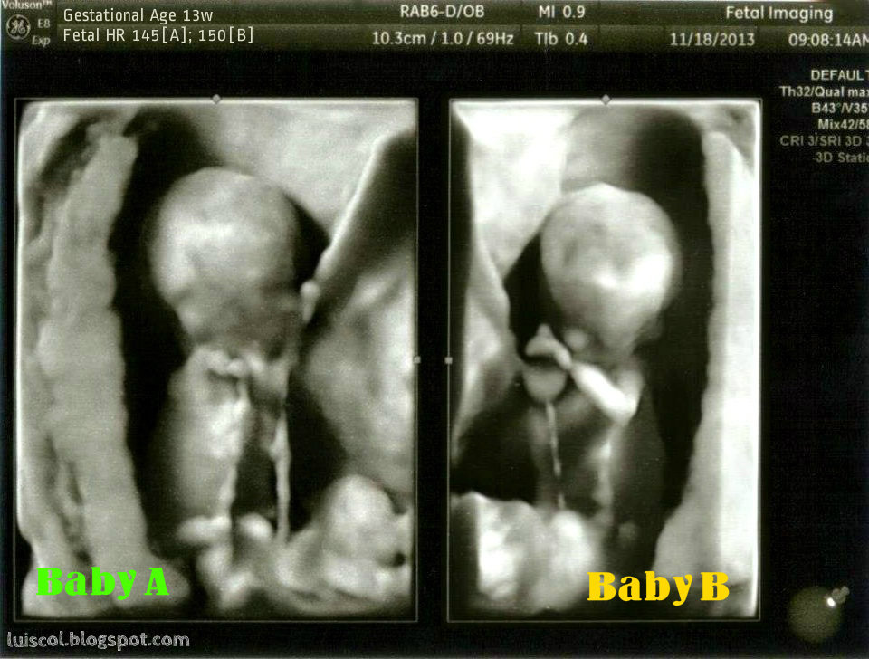 My Stories: Heavenly miracles and more: December 2013