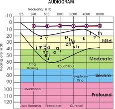 How to Read an Audiogram - Lessons in Speech with Nanette