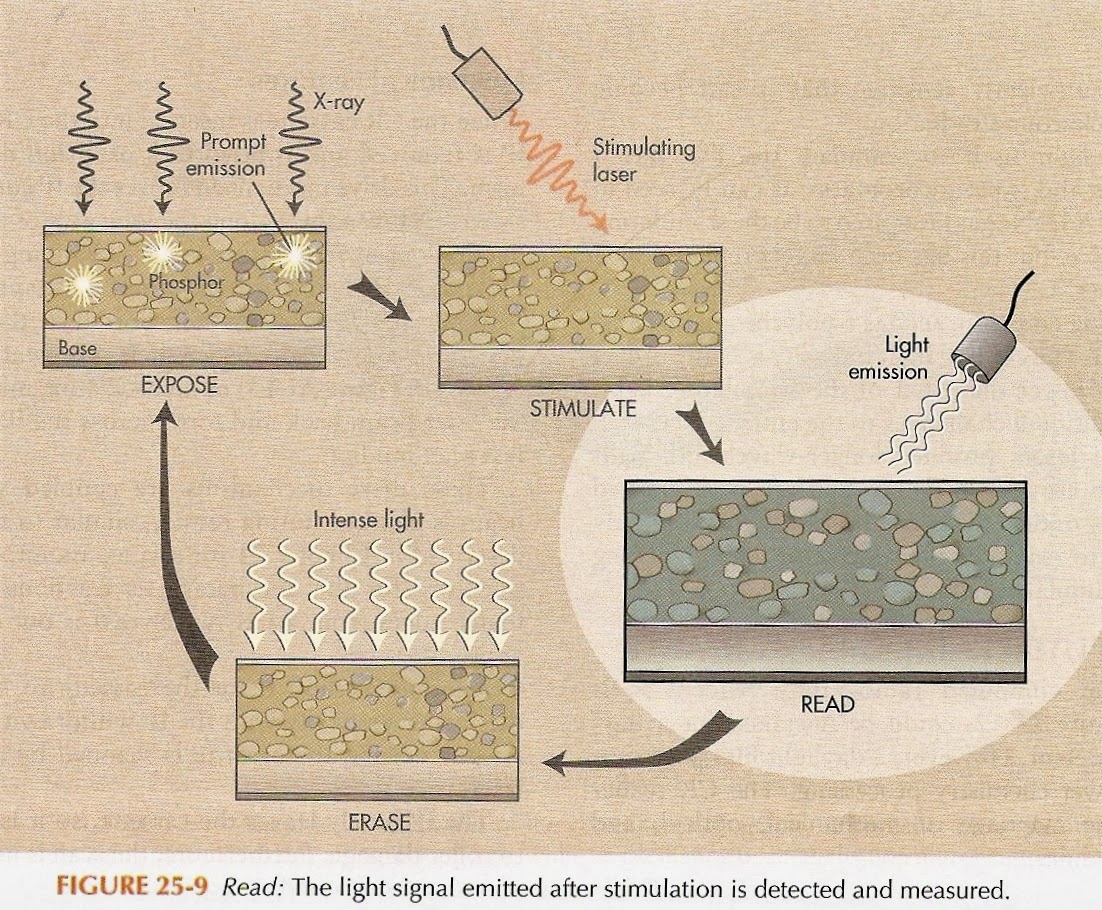 Radiodiagnostik Pemula: Komputer Radiologi (CR)