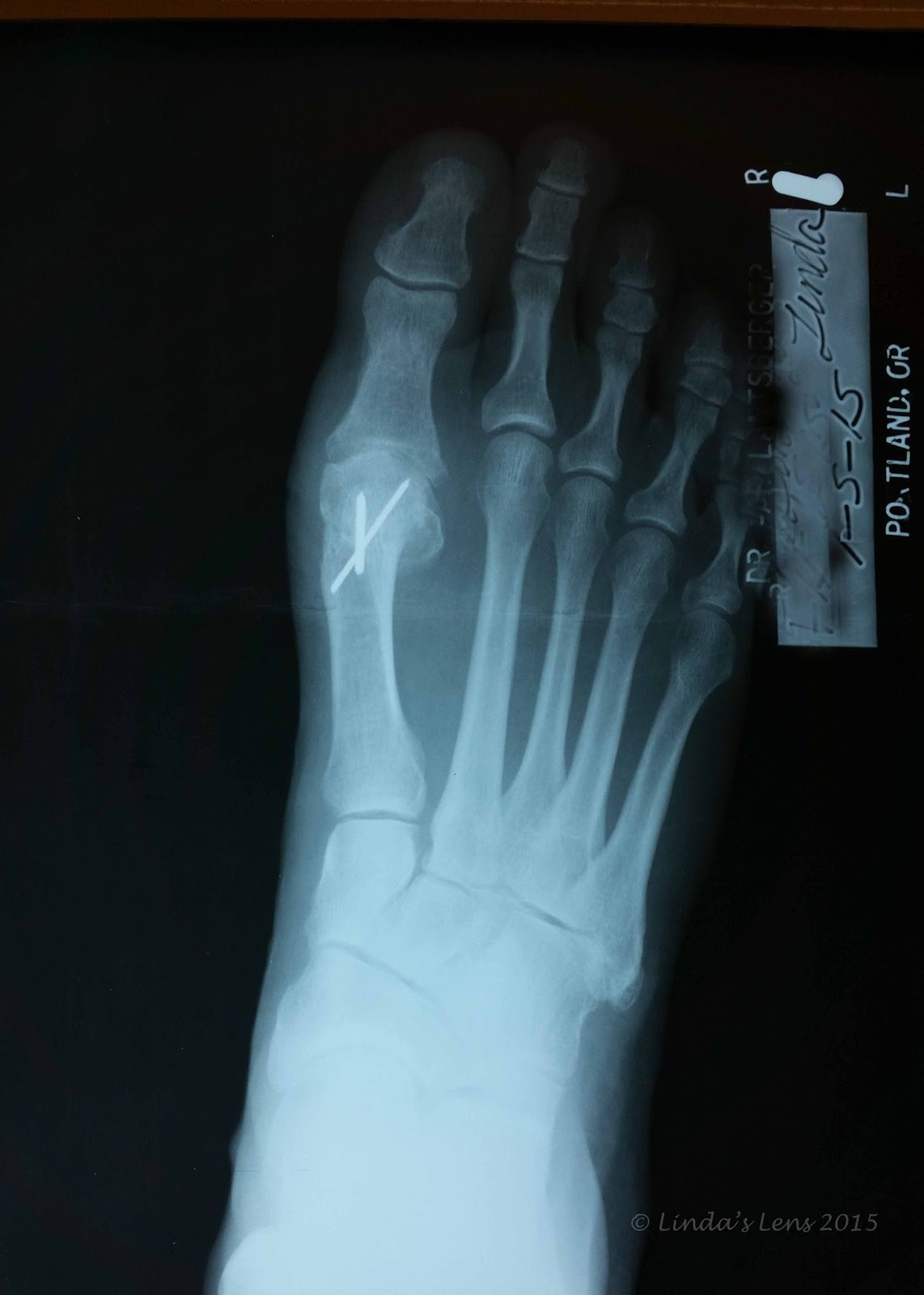 Linda's Lens: Those Pesky Pins....