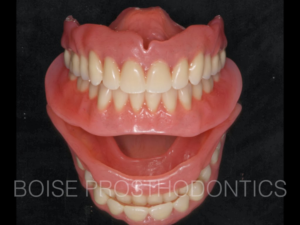 Boise Idaho Prosthodontics: Immediate Load Implant Prosthesis - Hybrid