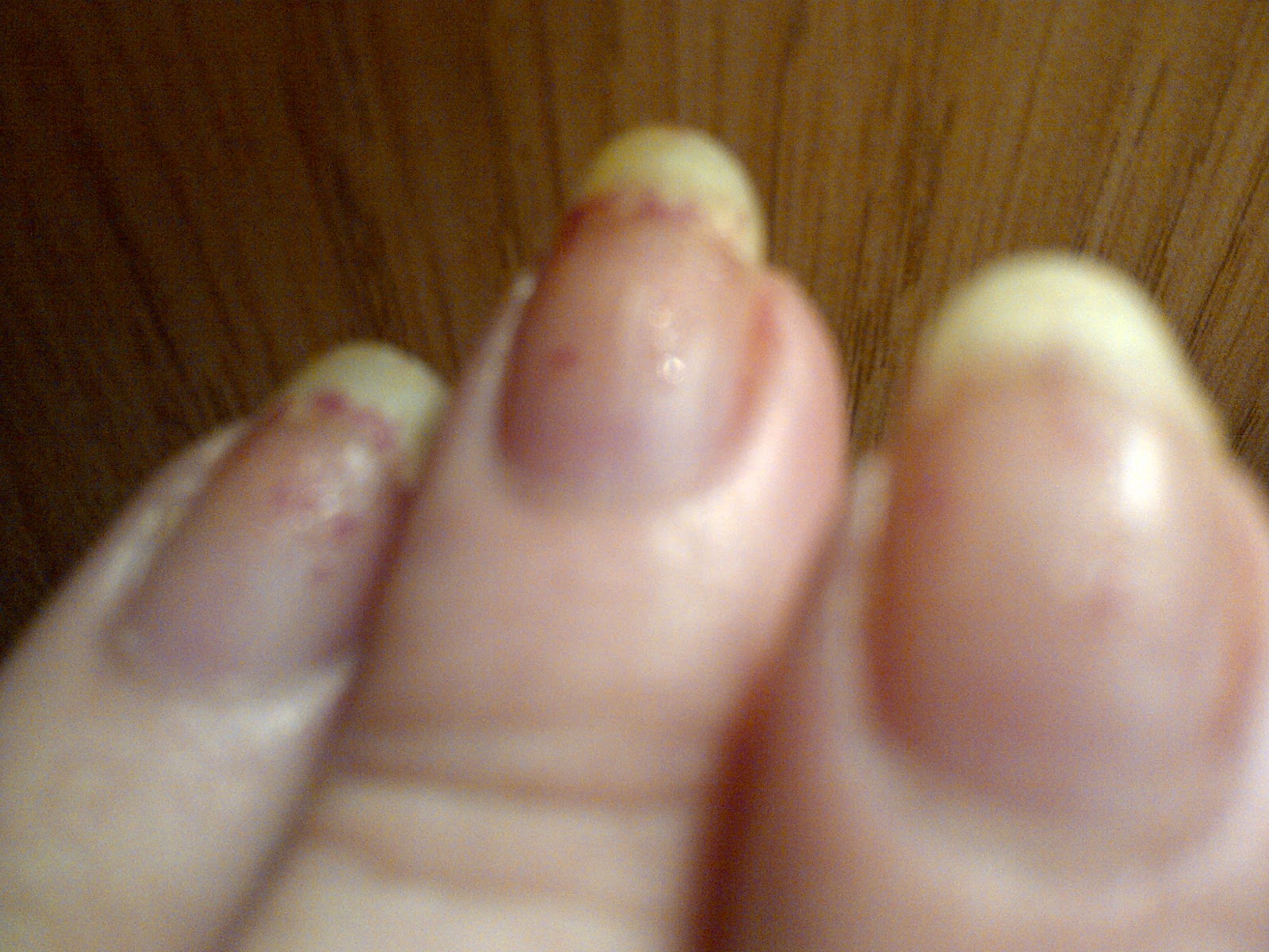 SensatioNail - Update! 3 weeks on...