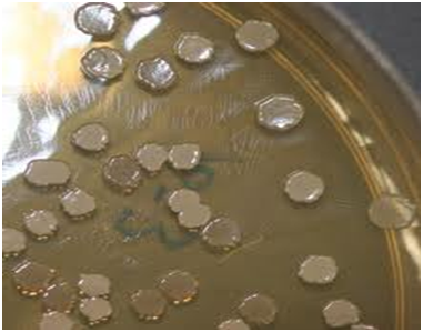 MICROBIOOLOGIA Y PARACITOLOGIA : Bacillus Subtilis