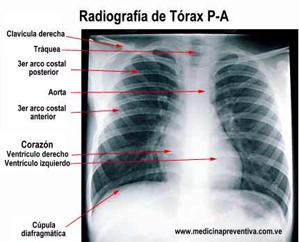 Anatomia Radiologica UAM: anatomía del tórax