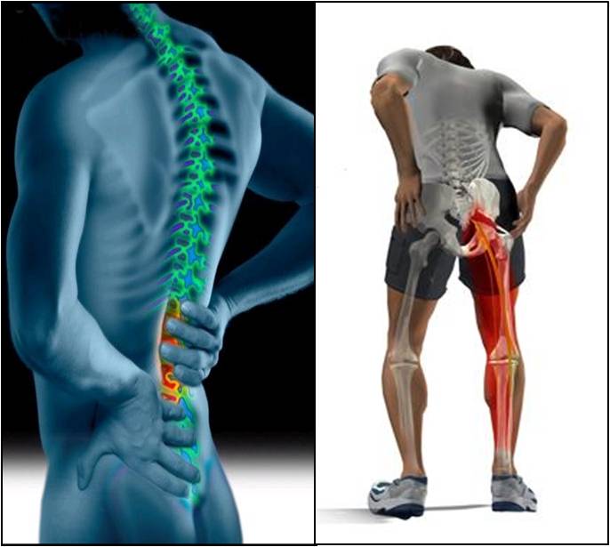 PSYCORPORE: Lombalgia