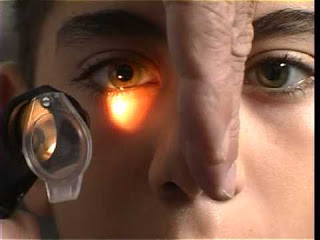 Semiología Y Salud: OJO