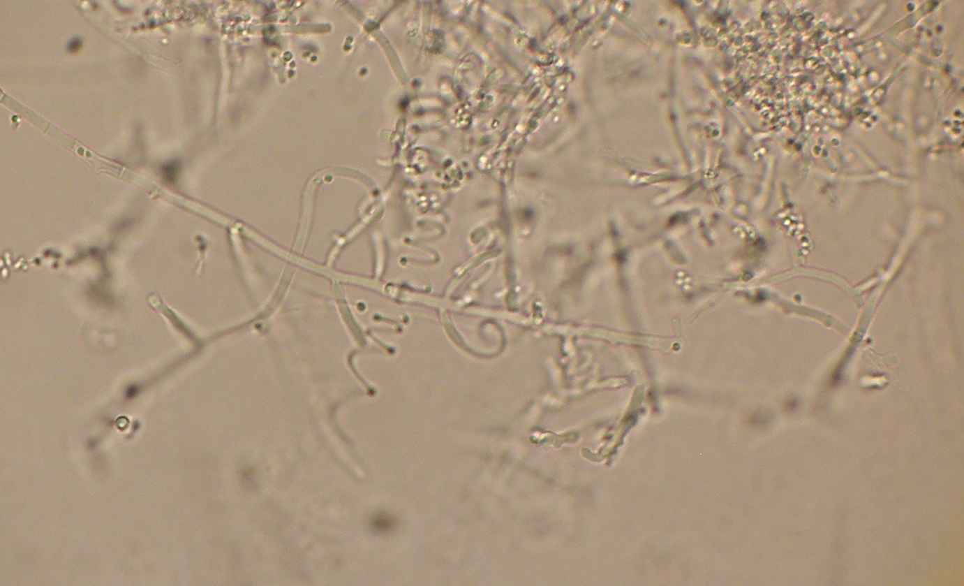 ATLAS MICOLOGIA: TRICHOPHYTON MENTAGROPHYTES