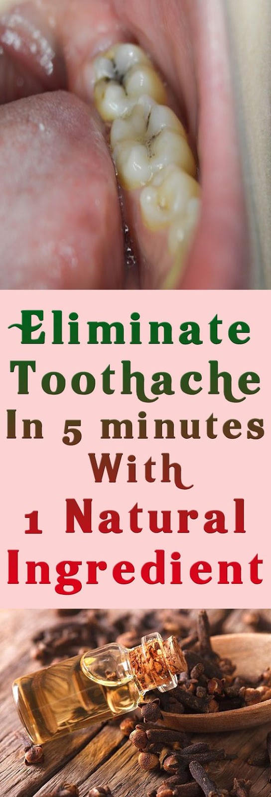 Eliminate Toothache In 5 minutes With 1 Natural Ingredient - HEALTH ...