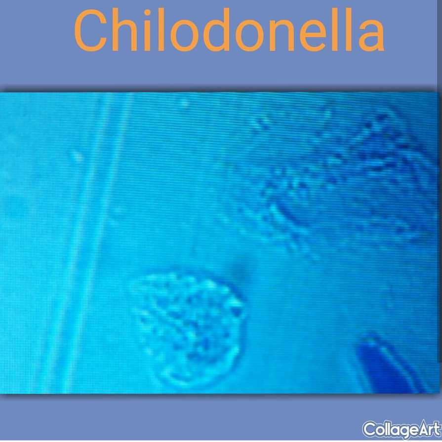 Michele's Microscopy: Chilodonella