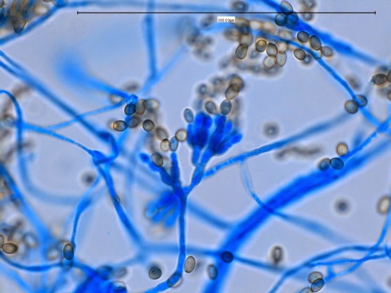 Fun With Microbiology (What's Buggin' You?): Scopulariopsis brumptii