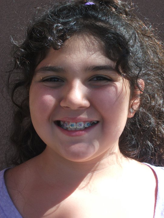 The Bumpy Ride: (43-303) The Wonderful World of Braces