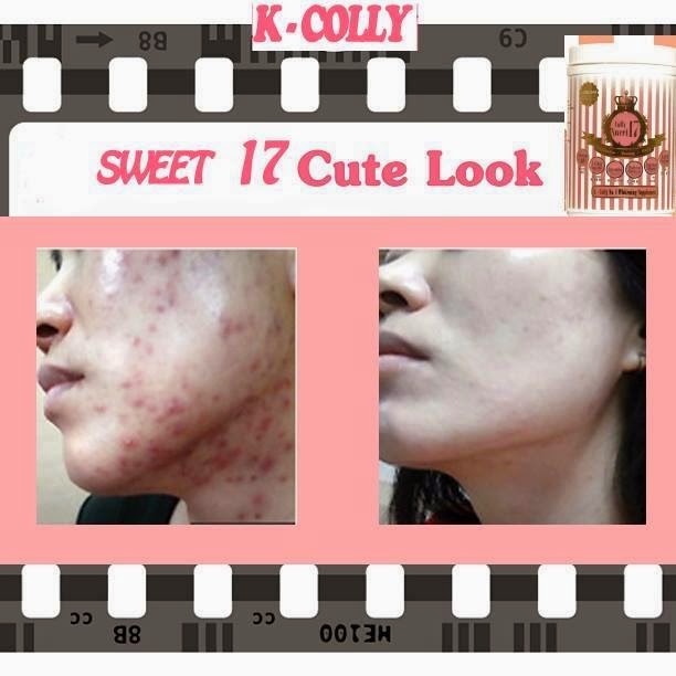 K-COLLY SWEET 17 COLLAGEN ORIGINAL | Cik Puan Inash