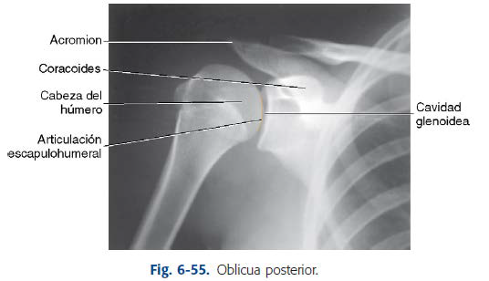 PRODUCCION Y TRATAMIENTO DE IMAGENES DIAGNOSTICAS: CAPITULO HUMERO Y ...