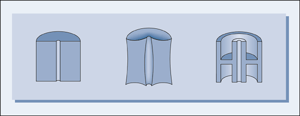 Mold technology: Coring