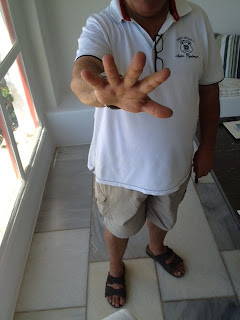 Murder is Everywhere: Obscene Gestures of the Ancient Greek