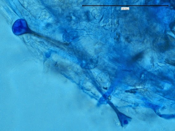 Fun With Microbiology (What's Buggin' You?): Apophysomyces elegans ...