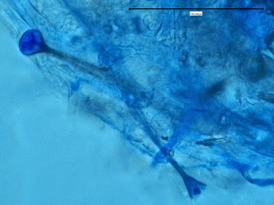 Fun With Microbiology (What's Buggin' You?): Apophysomyces elegans ...