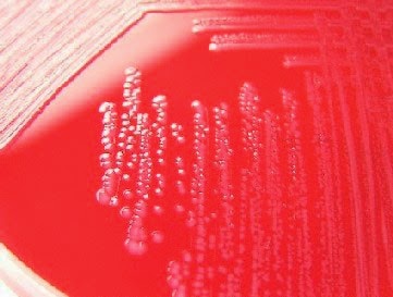 Blood Agar Plate Dan Uji Hemolisi