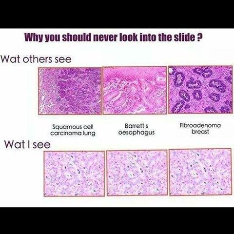 harimohans: Tissue is the issue