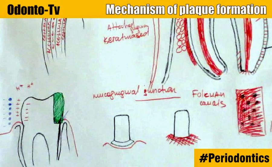 DENTAL PLAQUE: Mechanism of formation - Dra. Velina Zankova