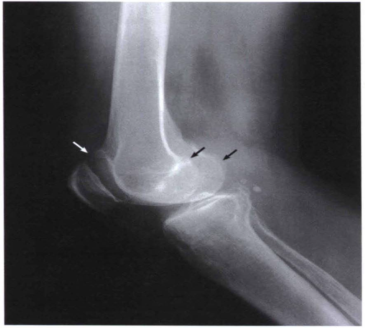 teknik radiografi: 2017