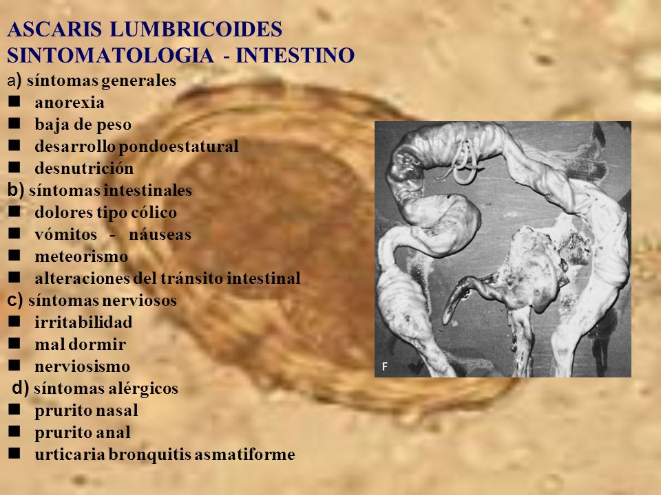 ¡Cuidemos la salud de todos!: Parásitos - ASCARIASIS