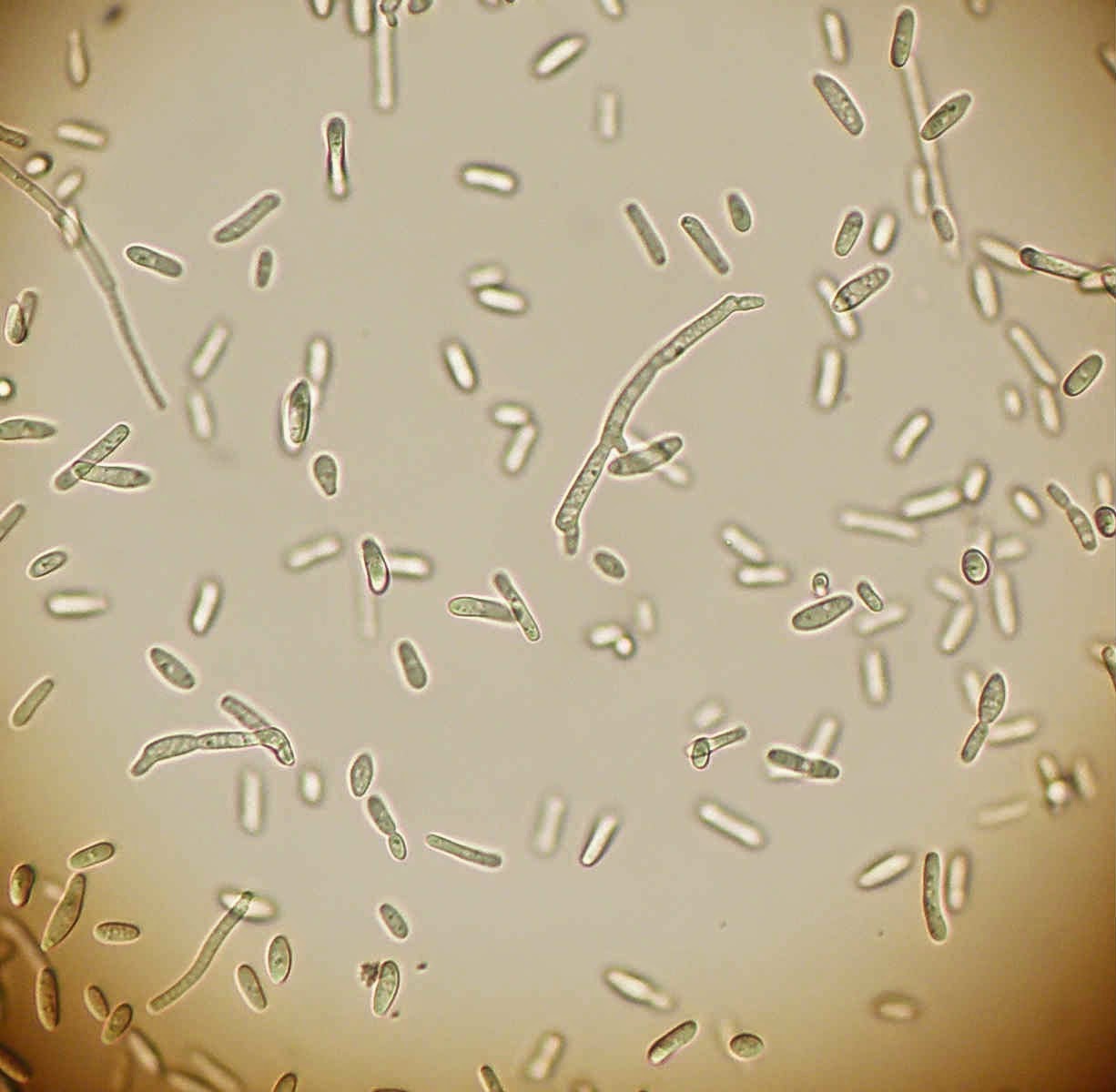ATLAS MICOLOGIA: MAGNUSIOMYCES CAPITATUS