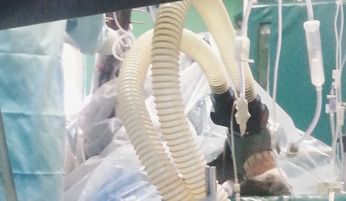 Wellington son combat pour la vie: EXPLICATIONS SUR LA TRANSFIXATION ...