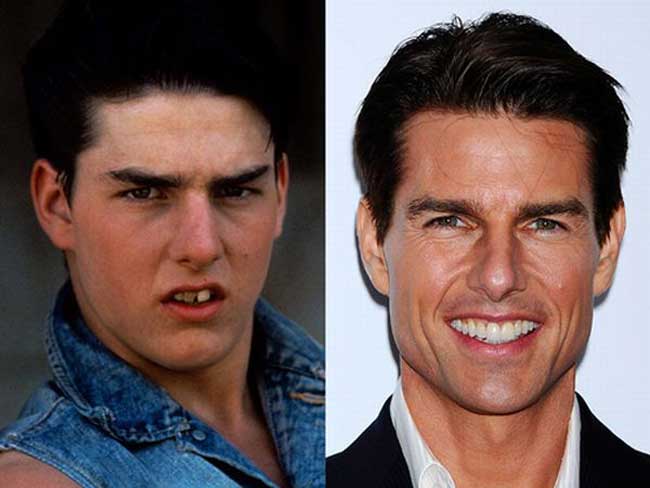 Tom Cruise has an asymmetrical face | Interesting Facts