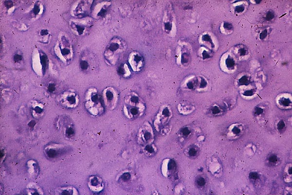 CINTIA; Blog de Instituto.: Teixits Connectius