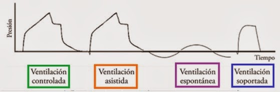 Cuidados de enfermería: ventilacion mecánica: Modos ventilatorios
