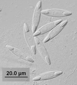 Real Monstrosities: Myxozoa