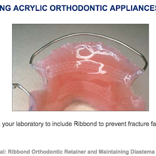 Dental Mart: Ribbond Ribbon Orthodontics 1mm