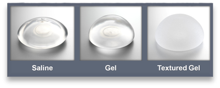 [Breast Augmentation:Mammoplasty] Types of Implants Used for Breast ...