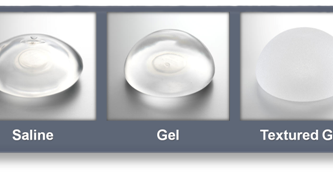 [Breast Augmentation:Mammoplasty] Types of Implants Used for Breast ...