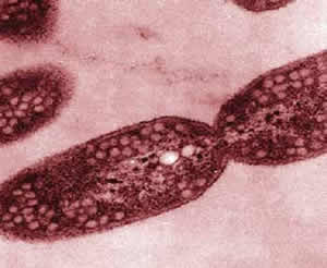 Delsa's Blog: Bakteri Fotosintesis