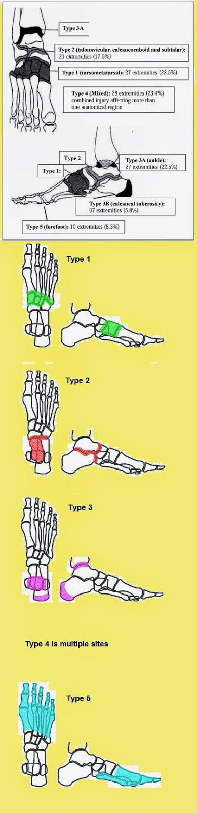 hEiDiMatEs - MeDICinE: Diabetic charcot neuroarthropathy : Classification