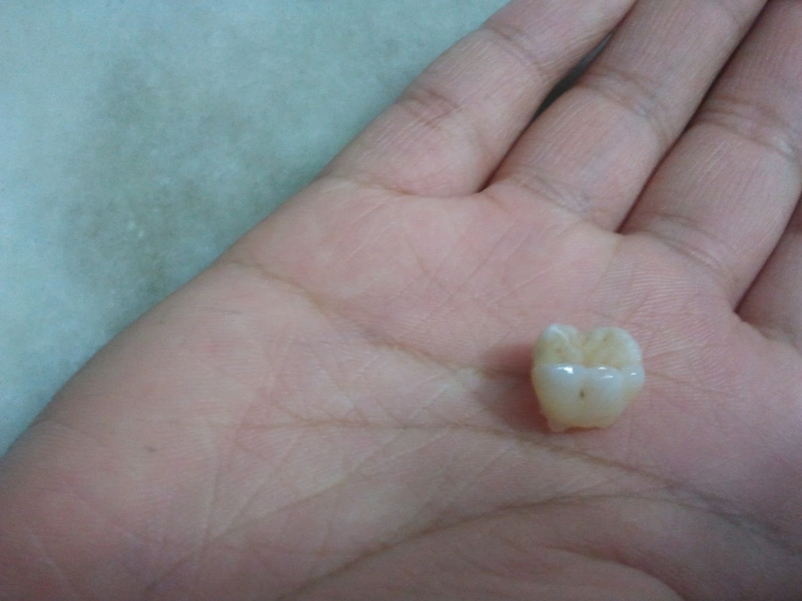 miawmiaw.com: Jaden's first fallen tooth