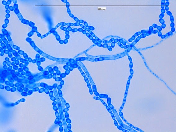 Fun With Microbiology (What's Buggin' You?): Trichosporon species