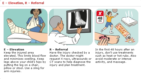 2GSIM MARTA MOYA: RICER: first aid for sprains, strains and fractures