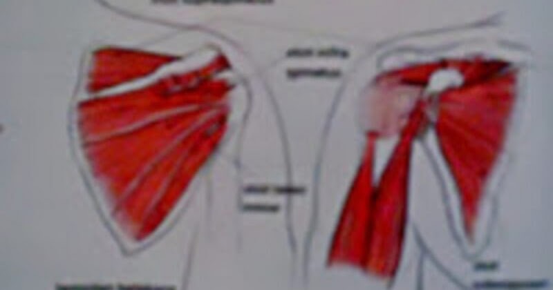 Penyebab Dan Cara Mengatasi Robeknya Rotator Cuff - Klinikabar
