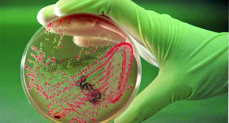 apa itu bakteri e coli - hay dokter