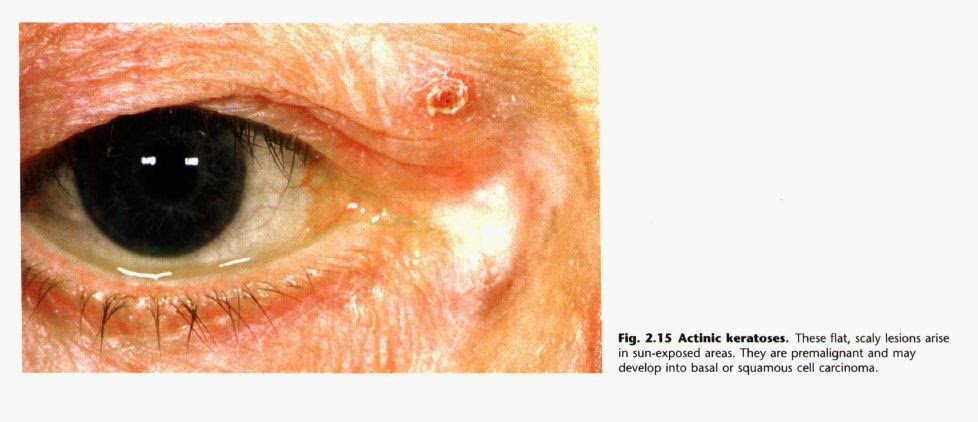 Ophthalmology OSCE