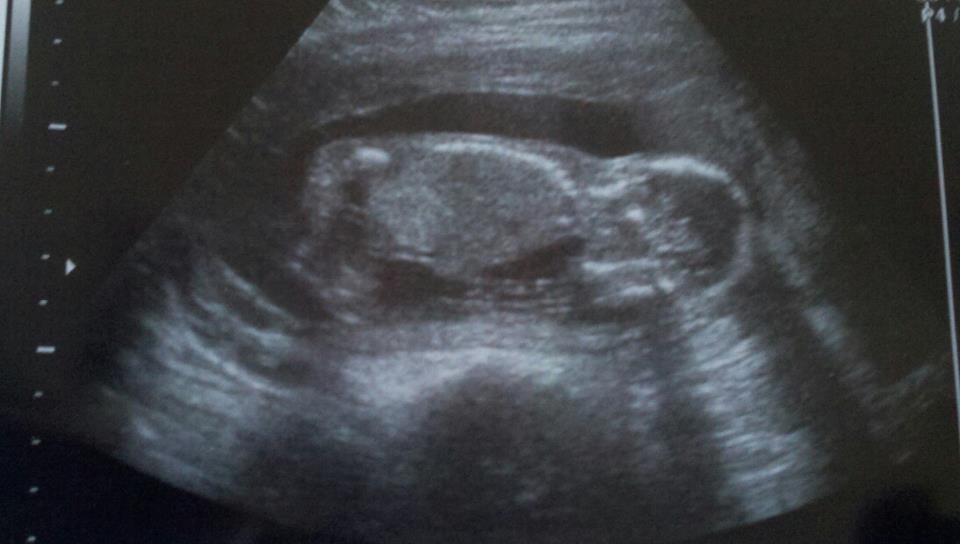 The Journey to the Hoolihan Peanut